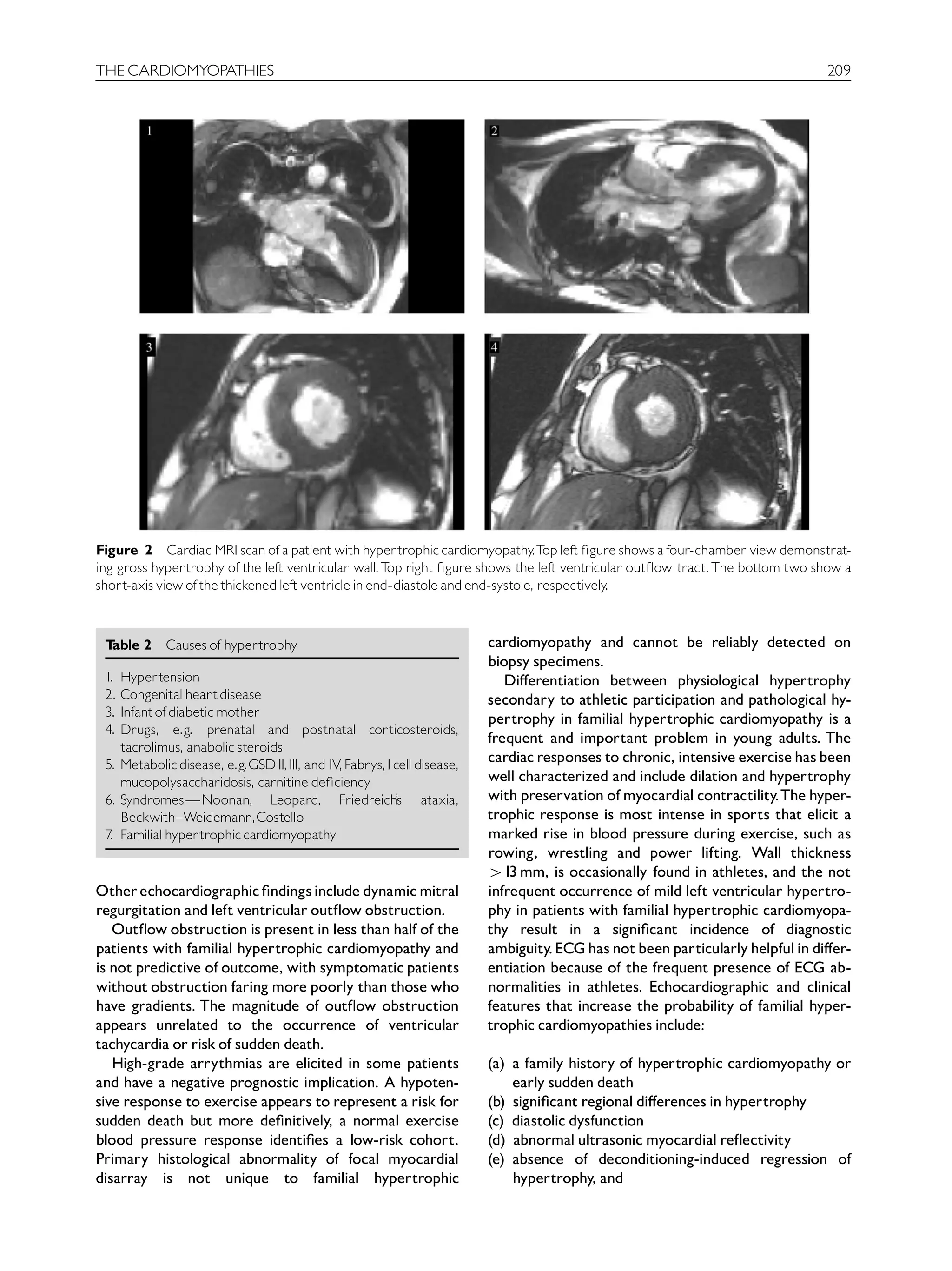 The cardiomyopathies | PDF