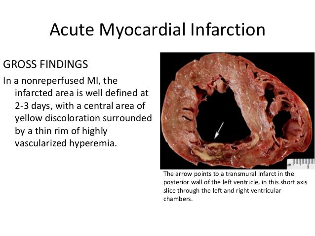 The cardiovascular system part 1