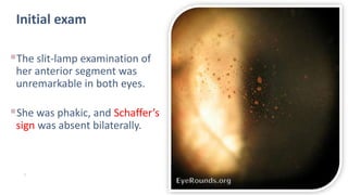 The case of the mysterious break | PPT