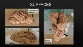 ANATOMY OF THE CEREBRUM WITH CLINICAL ANATOMY.pptx