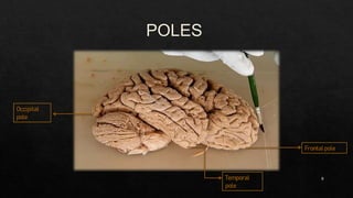 ANATOMY OF THE CEREBRUM WITH CLINICAL ANATOMY.pptx
