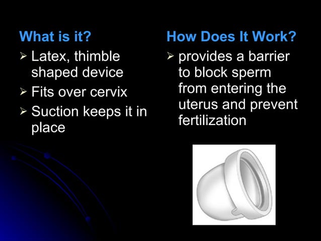 The Cervical Cap | PPT | Birth Control | Reproductive Health