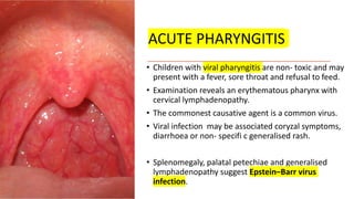 The child with a fever.pptx