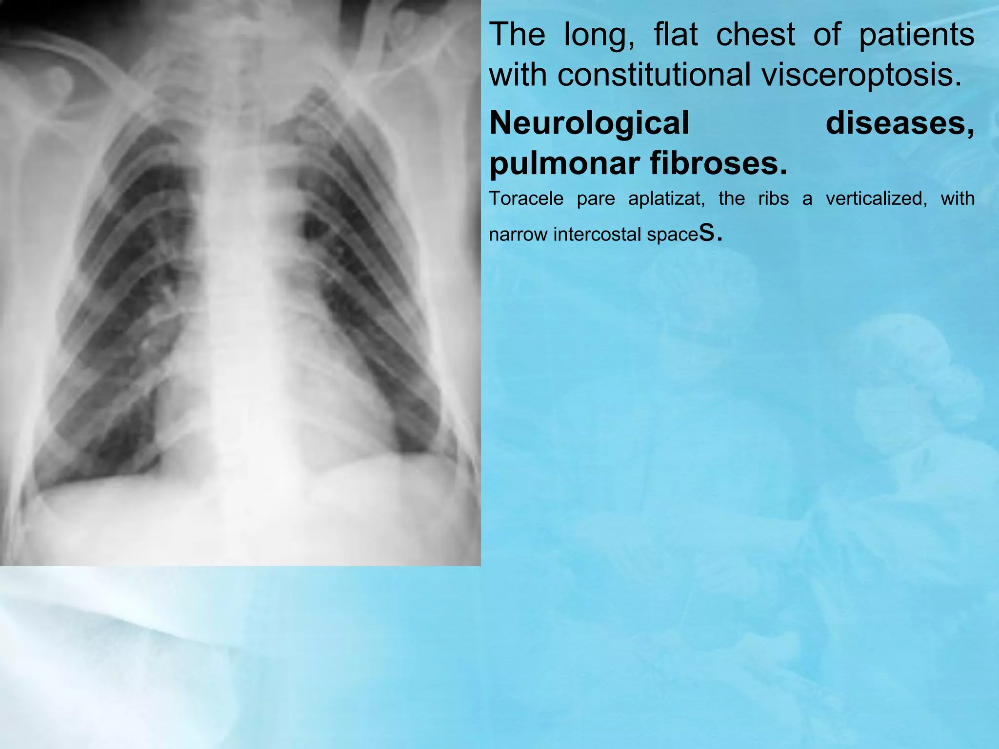 The clinical Anatomy of the Thorax. eng.pdf