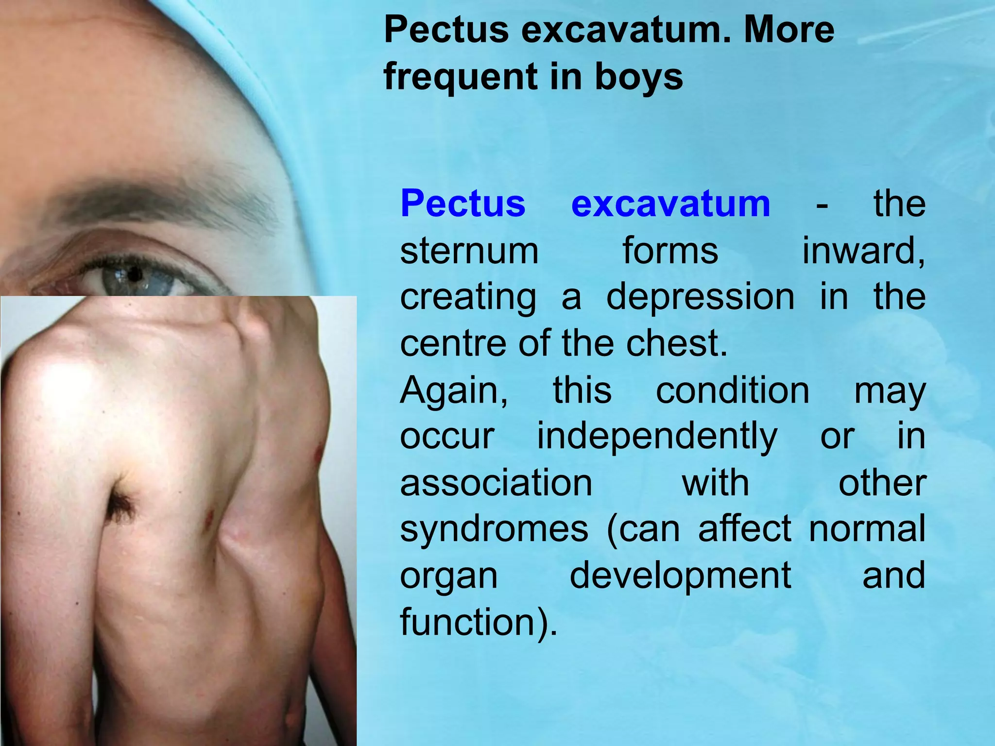The clinical Anatomy of the Thorax. eng.pdf