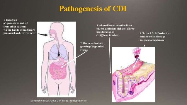 The colossal impact of clostridium difficile infection