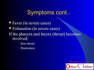 The common cold | PPT