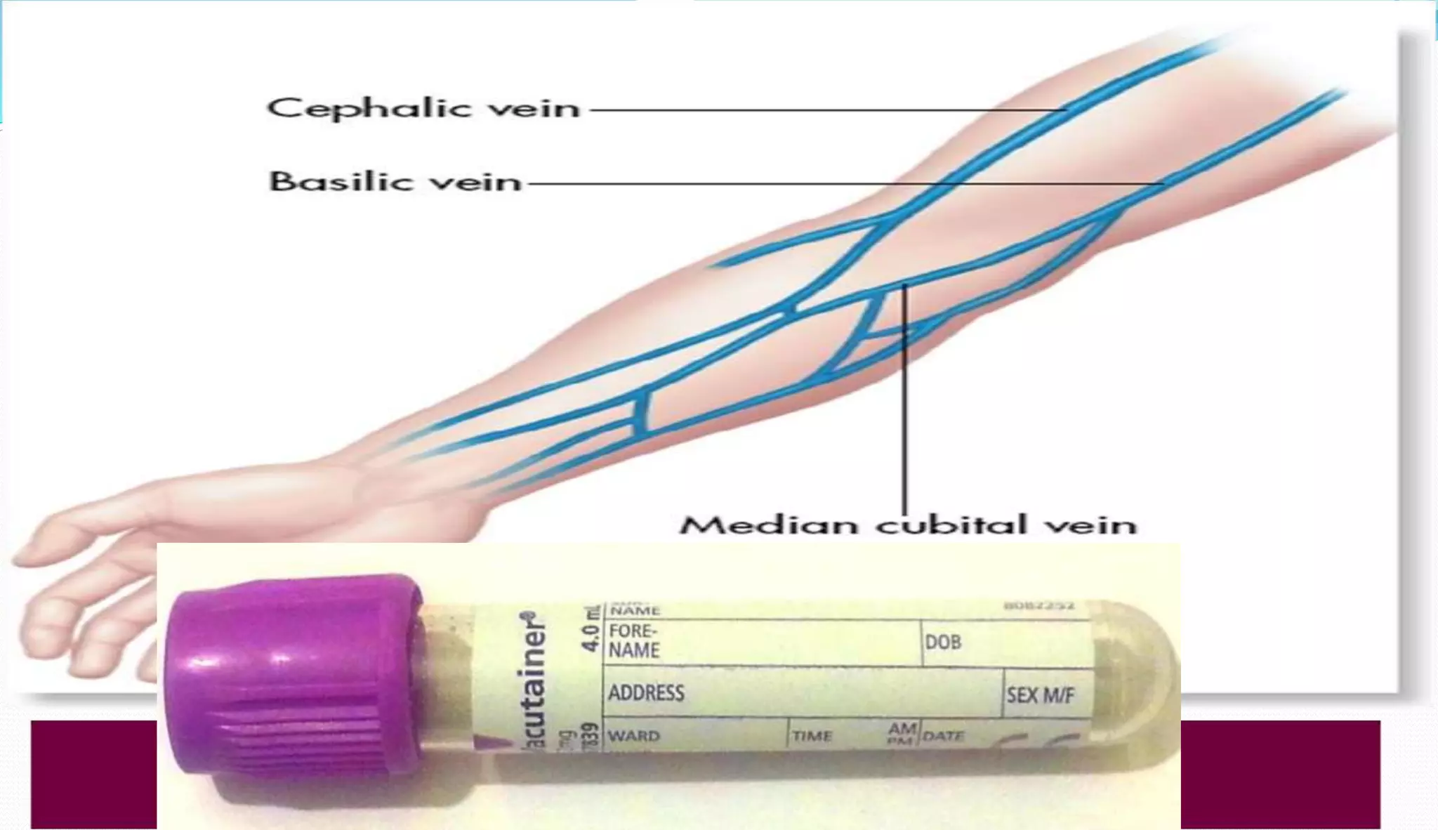 The complete blood count (cbc) | PPTX | Blood Disorders | Diseases and ...