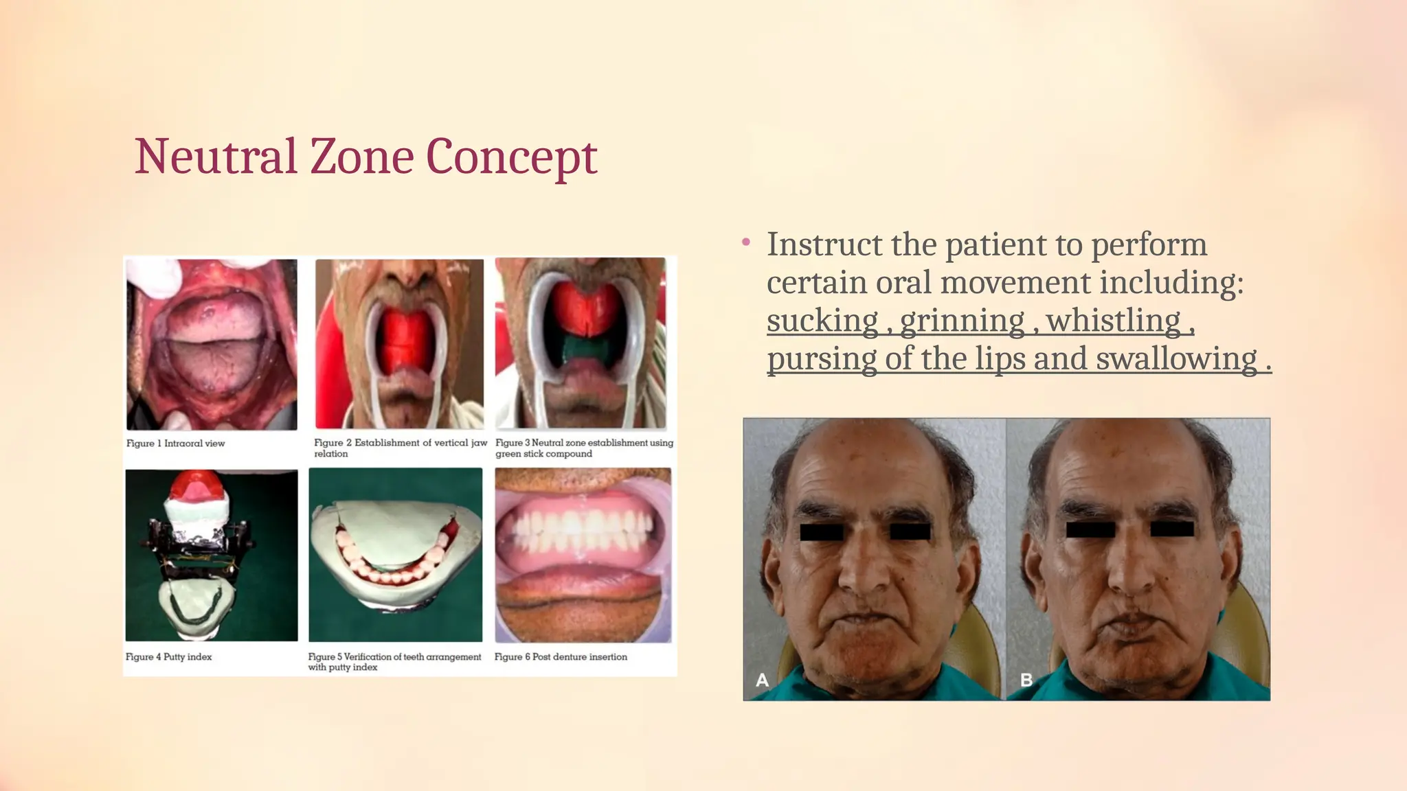 The concept of Neutral Zone in dental arch .pptx