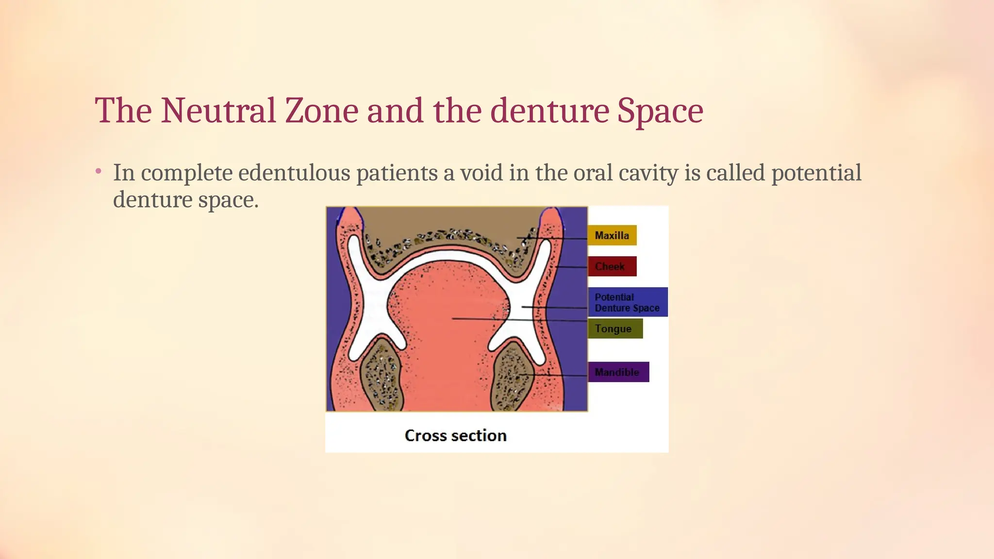 The concept of Neutral Zone in dental arch .pptx