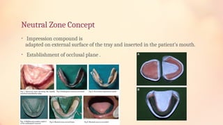 The concept of Neutral Zone in dental arch .pptx