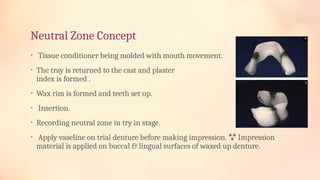 The concept of Neutral Zone in dental arch .pptx