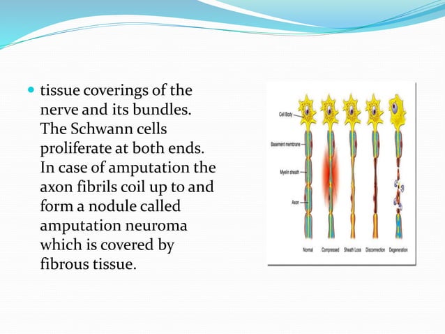 The concept of peripheral nerve repair | PPTX