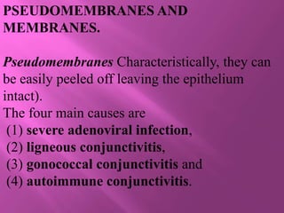 opthalmolgy.The conjunctiva lecture 1.(dr.ali) | PPTX