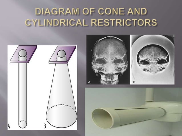 The control of scattered radiation | PPTX | Medical Tests | Medical Health