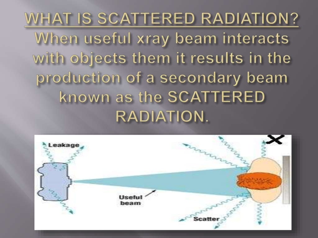 The control of scattered radiation