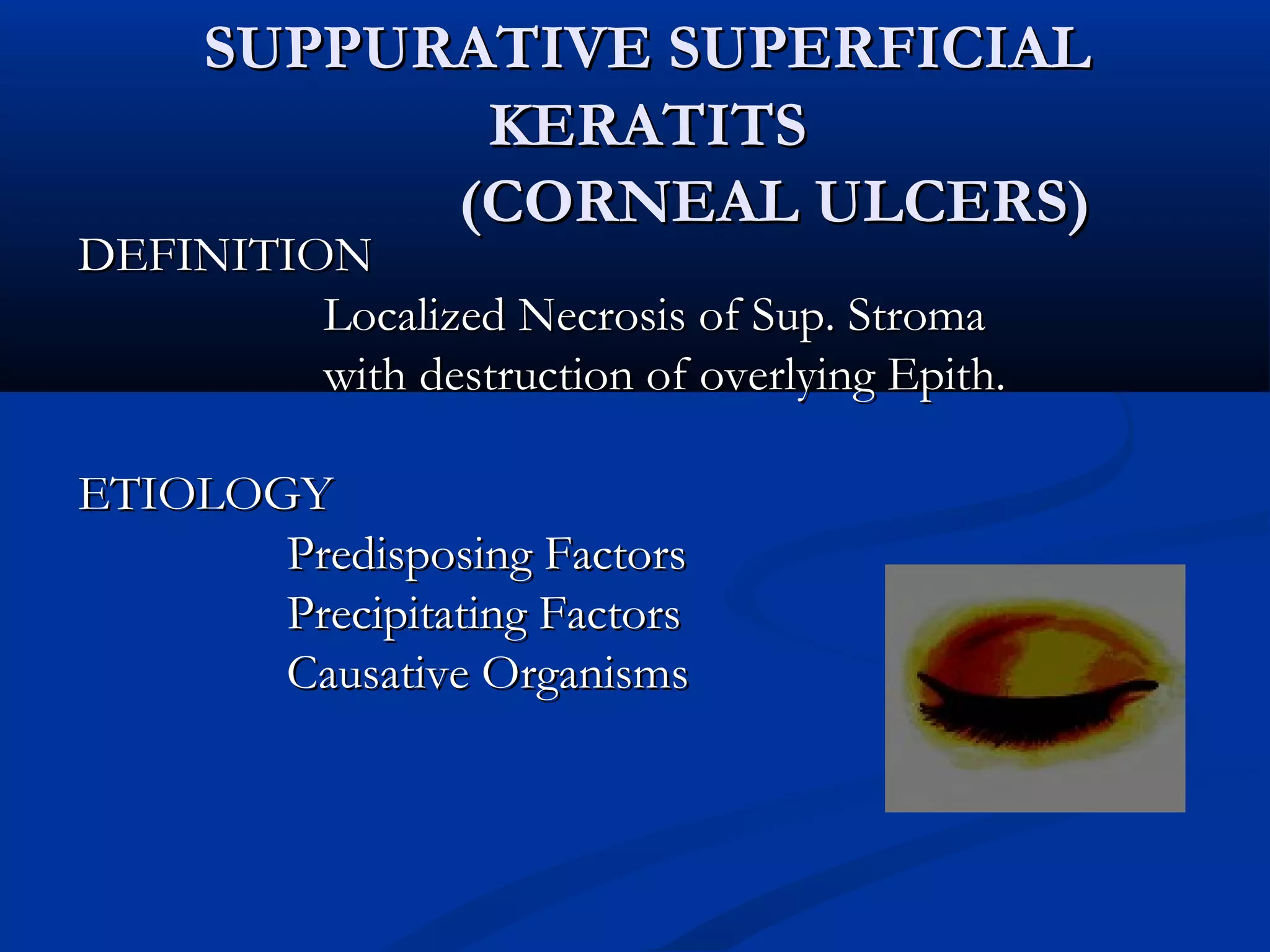all about cornea | PPT