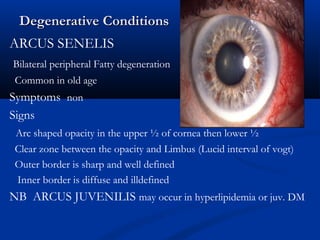 all about cornea | PPT