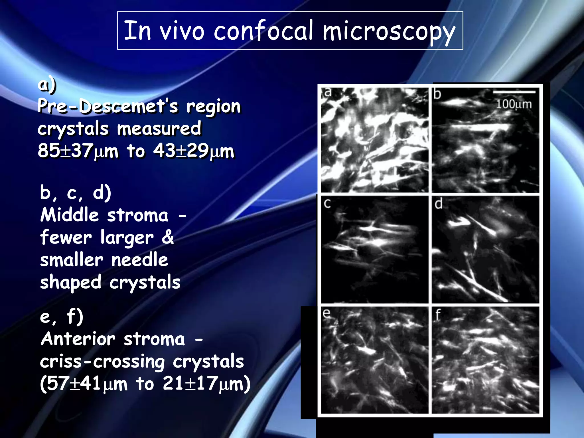 The corneal universe - mission possible by in vivo confocal microscopy | PPTX