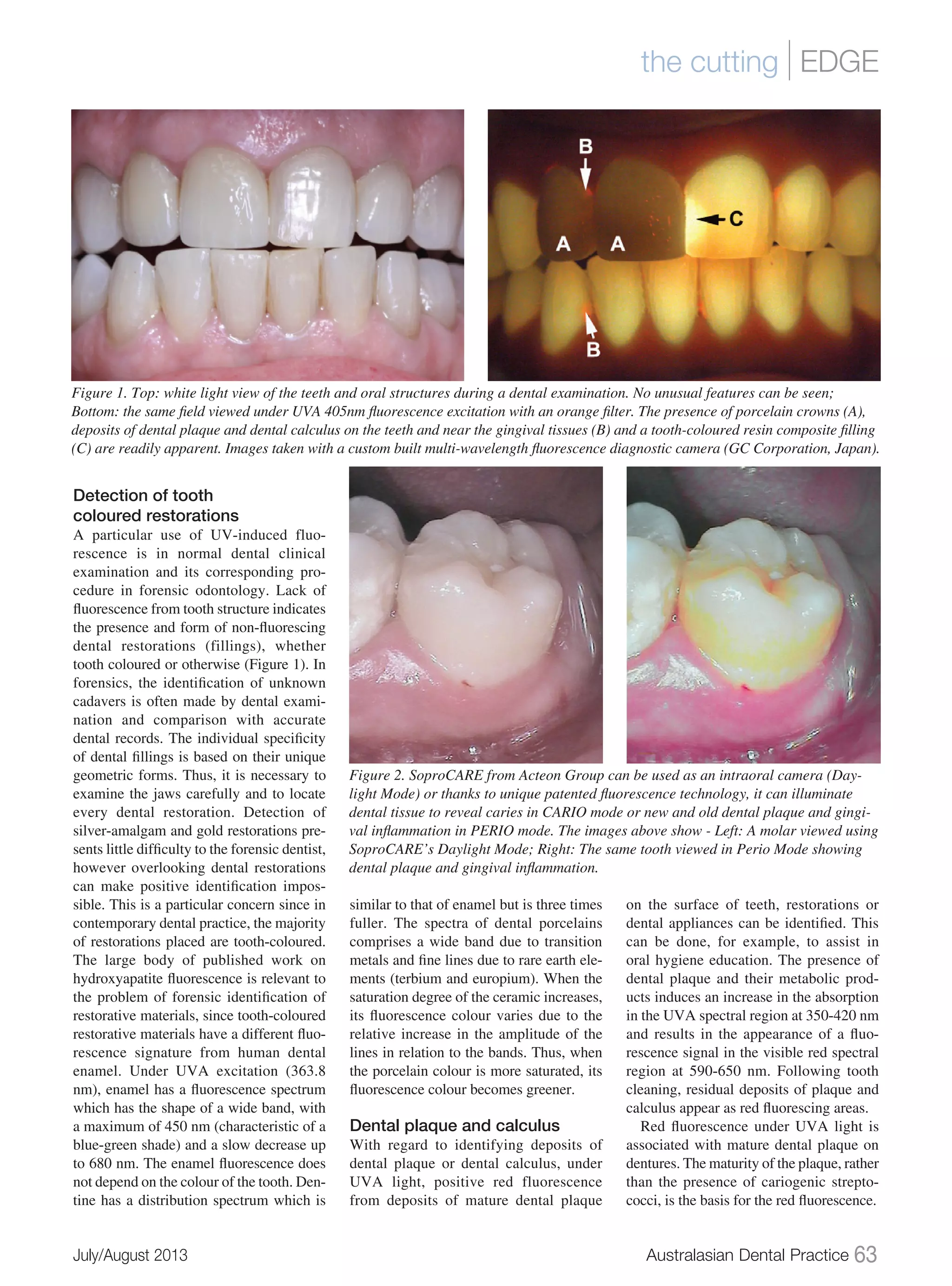 Fluorescence imaging in dental diagnostics: Current status and future ...
