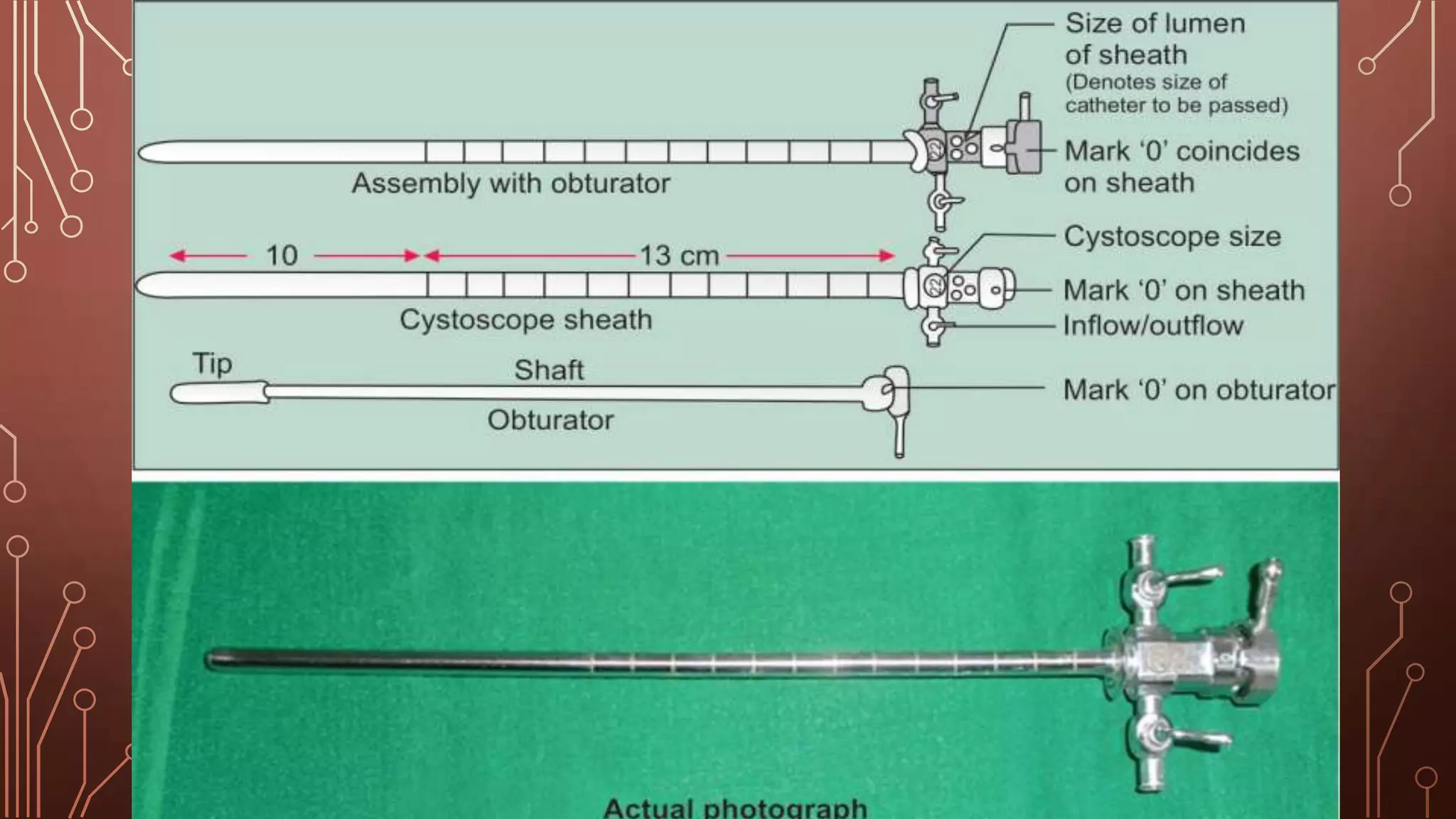 The cystoscope and accessories | PPTX