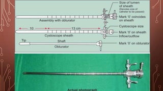 The cystoscope and accessories | PPTX
