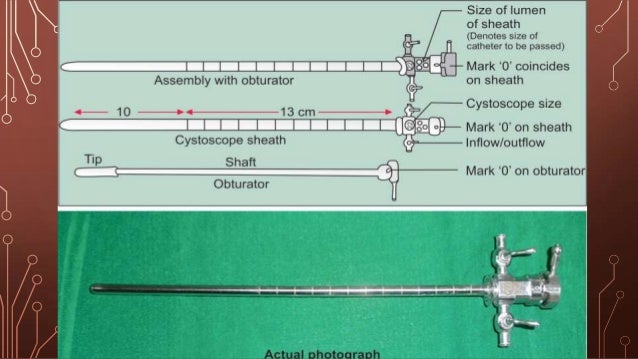 The cystoscope and accessories