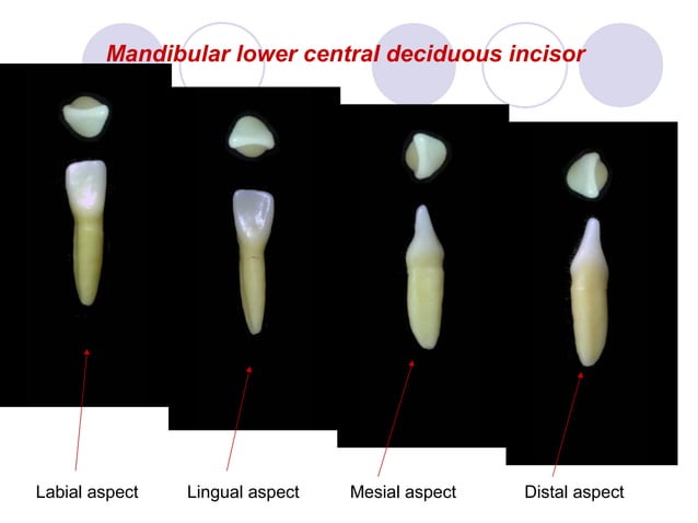 07. The Deciduous Teeth - Dentition | PPT | Dental Health | Diseases ...