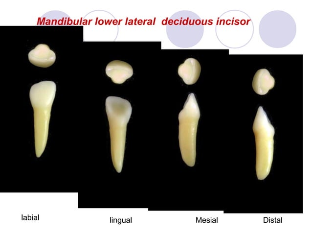 07. The Deciduous Teeth - Dentition | PPT | Dental Health | Diseases ...