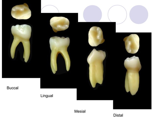 07. The Deciduous Teeth - Dentition | PPT | Dental Health | Diseases ...