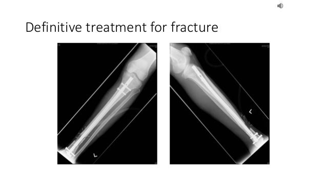 The decline of free flap surgery in lower limb reconstruction