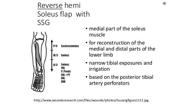 The decline of free flap surgery in lower limb reconstruction