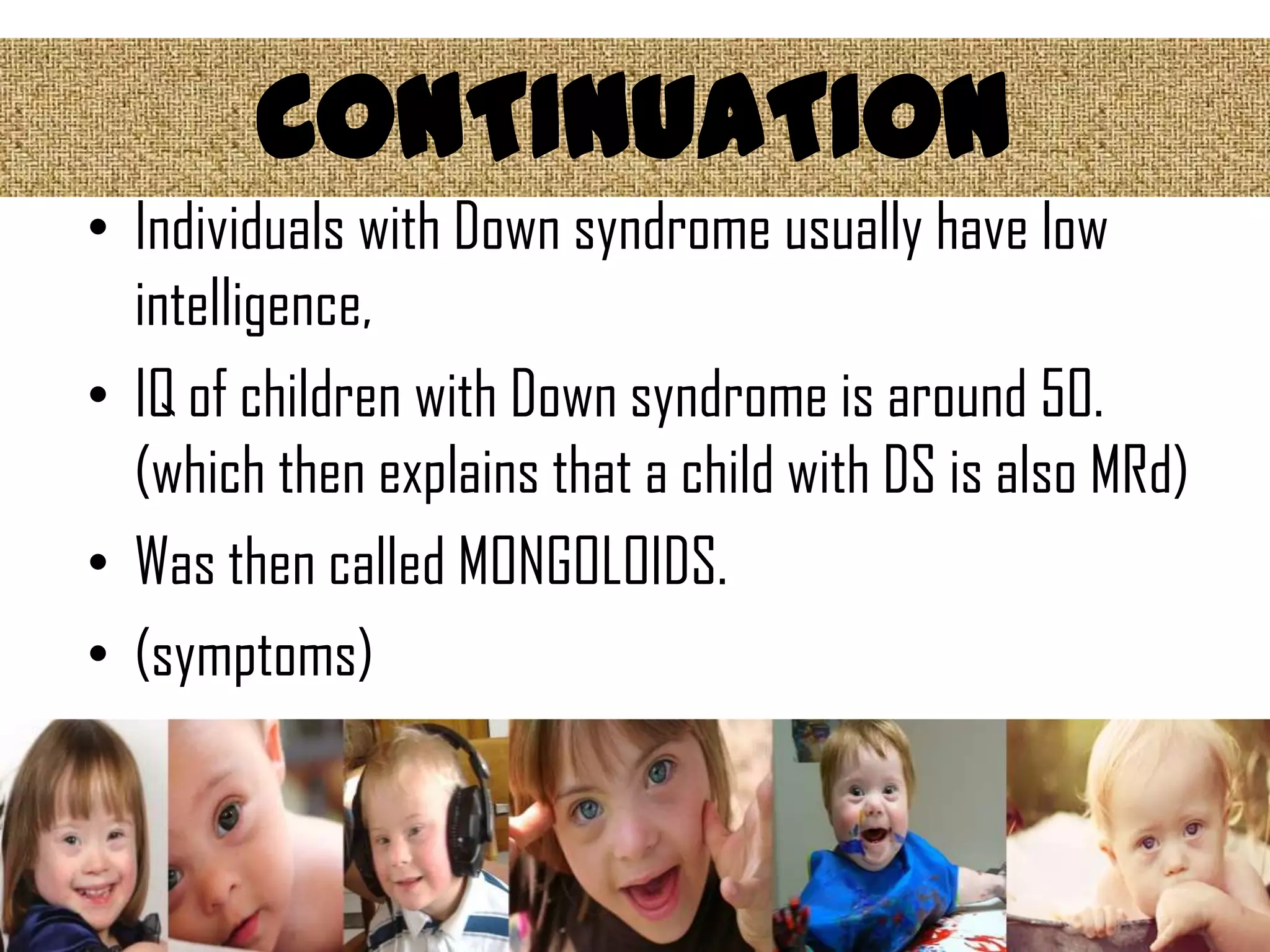 Language Development of Children with Down Syndrome | PPTX