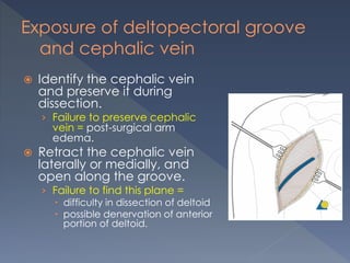 Deltopectoral Groove