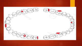 The dentition,eruption sequence,functions ,line point angles,oral ...