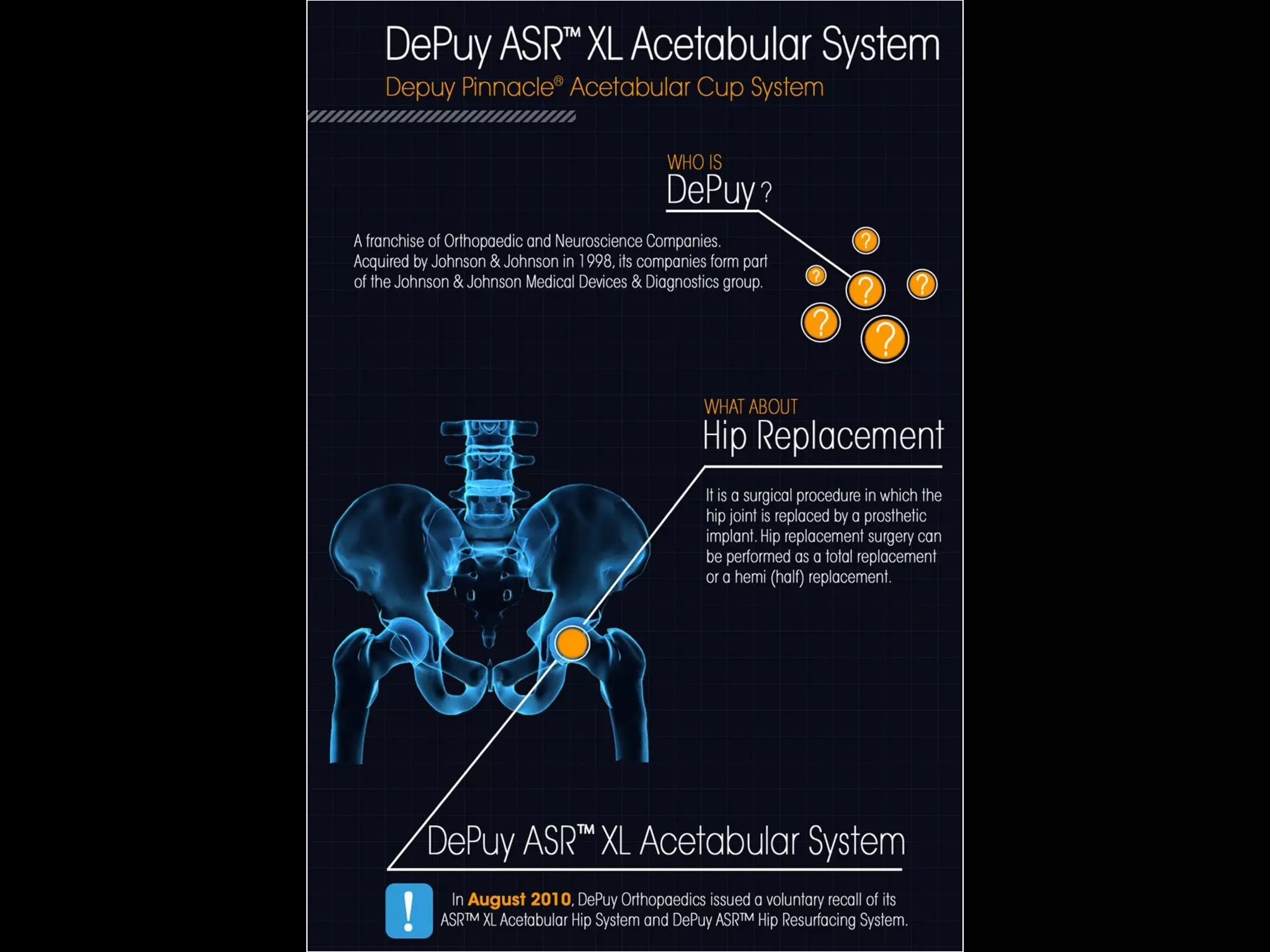 The Depuy ASR™ defective hip implant recall in pictures | PPT