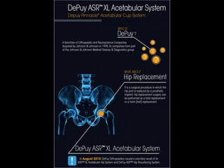 The Depuy ASR™ defective hip implant recall in pictures | PPT