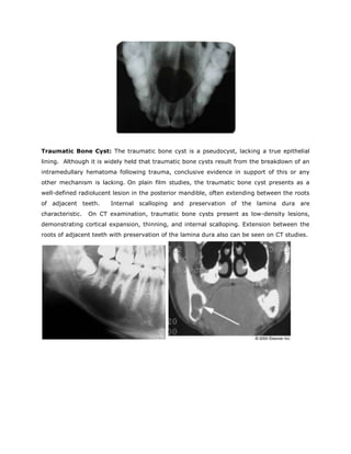 The diagnostic imaging of jaw lesions | DOCX | Dental Health | Diseases ...