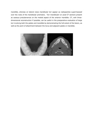 The diagnostic imaging of jaw lesions | DOCX | Dental Health | Diseases ...