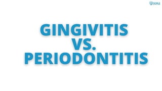 The Difference Between Periodontitis and Gingivitis | PPTX | Dental ...
