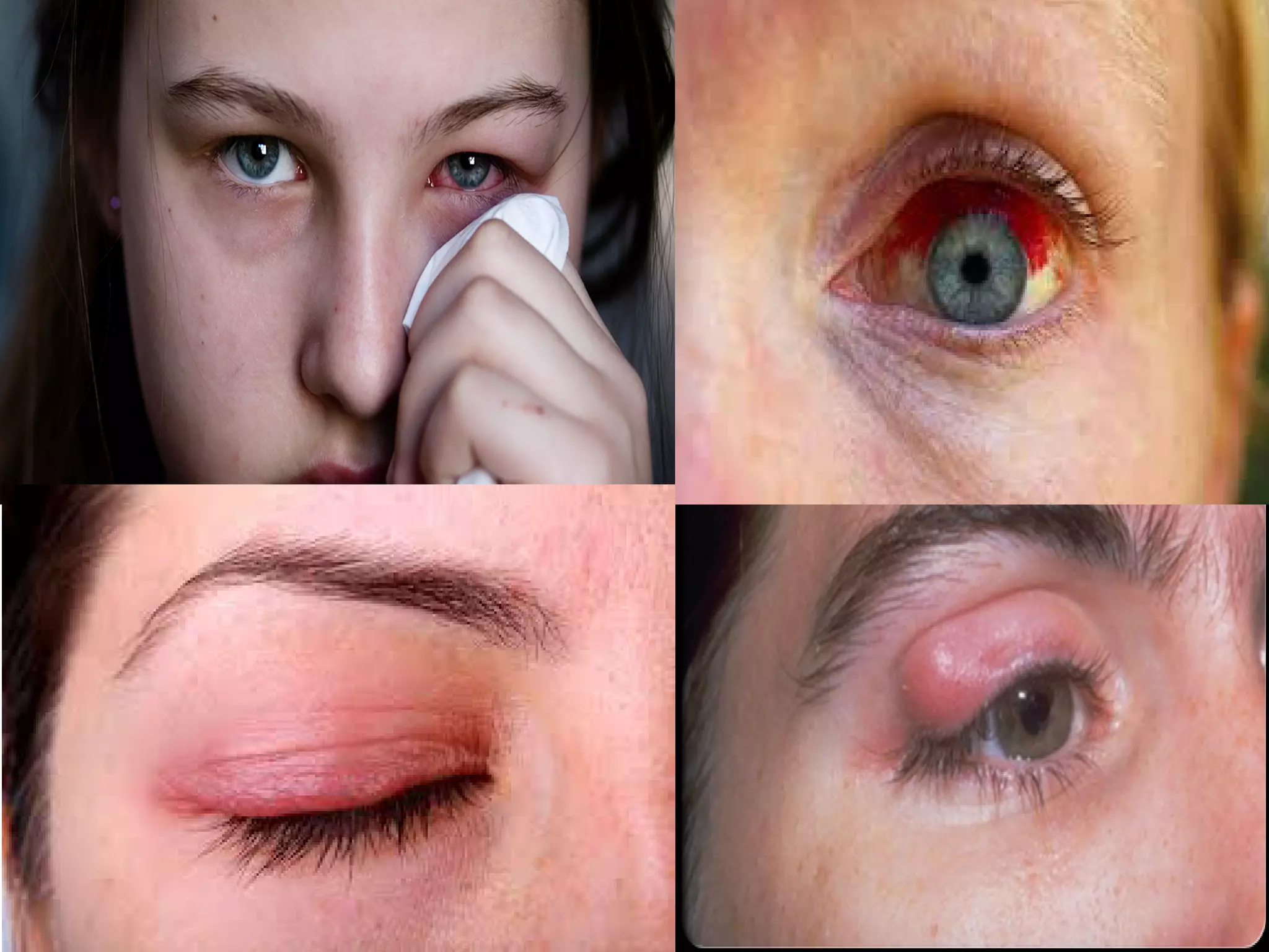 The different types of vision problems | PDF