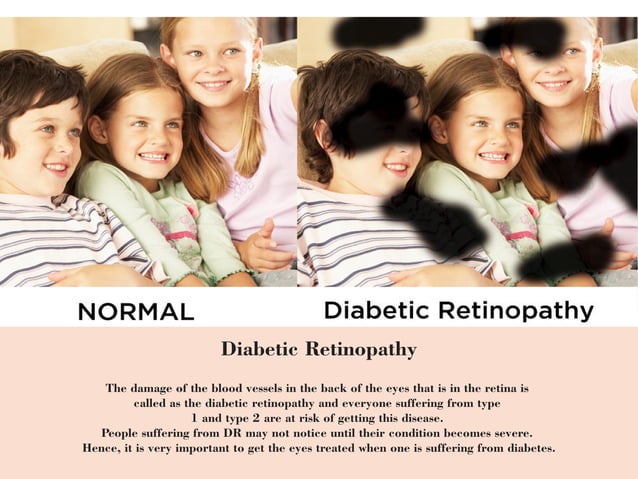 The different types of vision problems | PDF