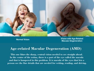 The different types of vision problems | PDF