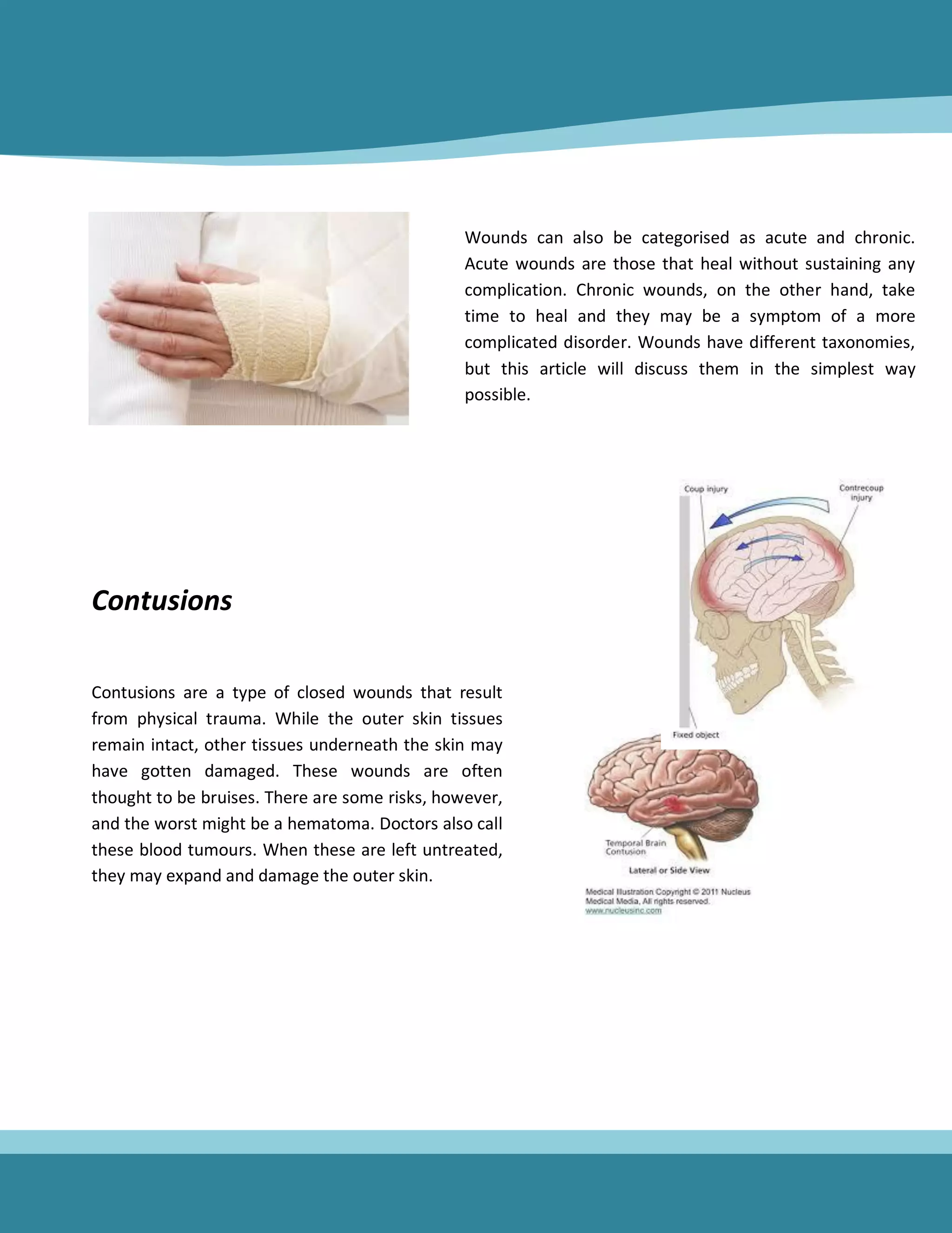 The Different Types of Wounds | PDF
