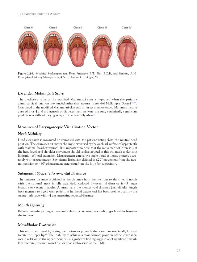 The Difficult Airway
