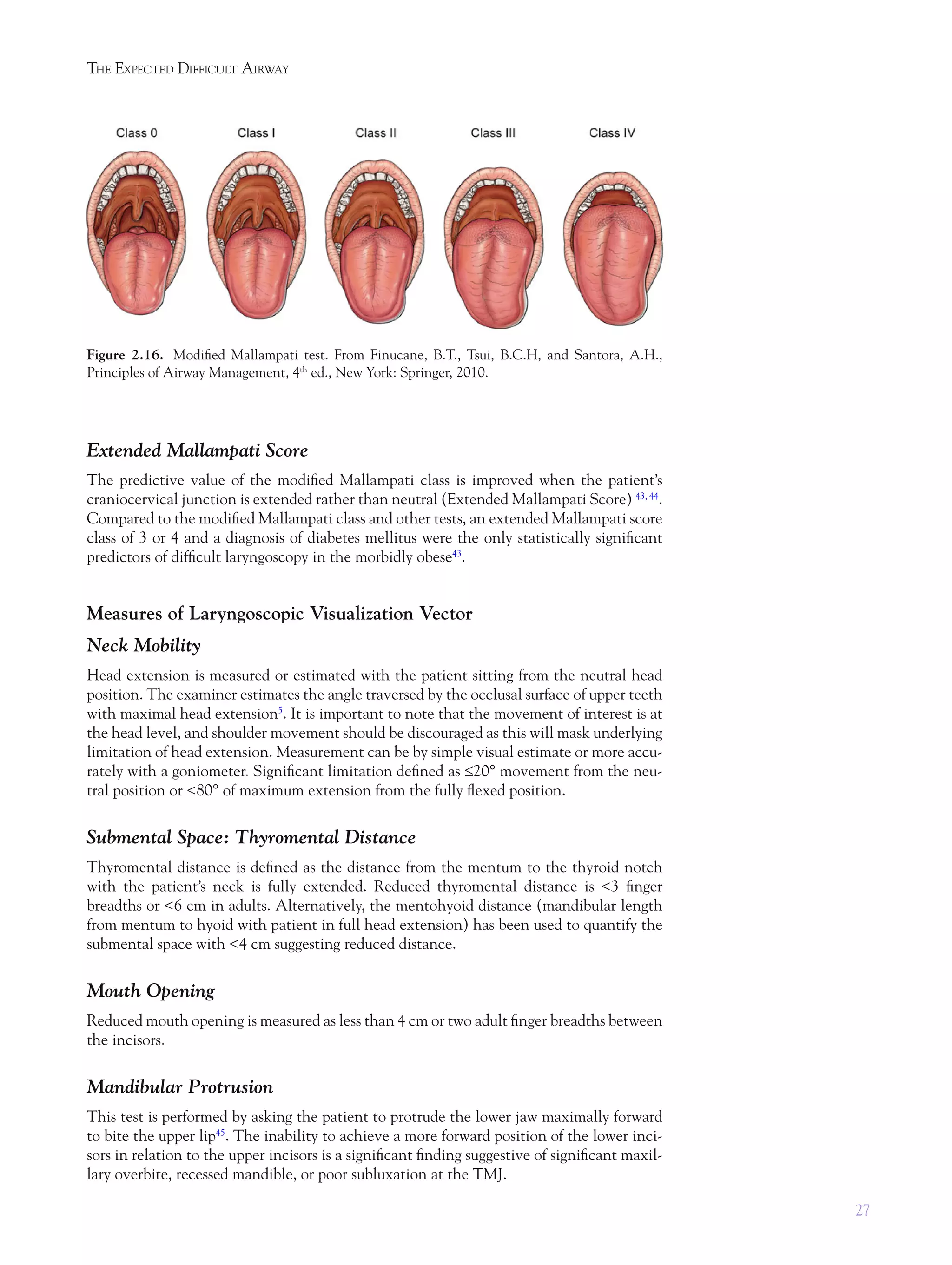 The difficult airway | PDF