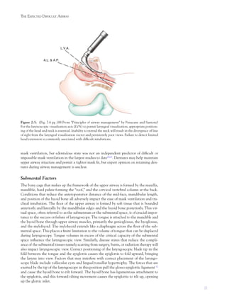 The difficult airway | PDF