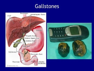 The digestive system | PPT