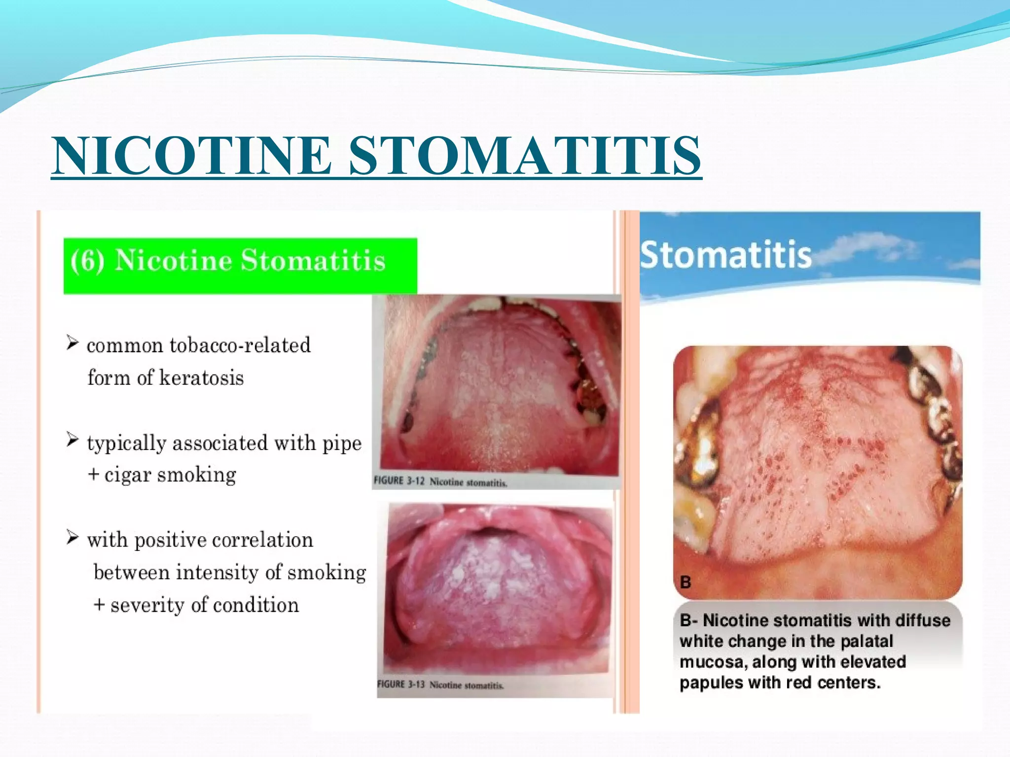 The digestive system [ Disease & Disorders] | PPT