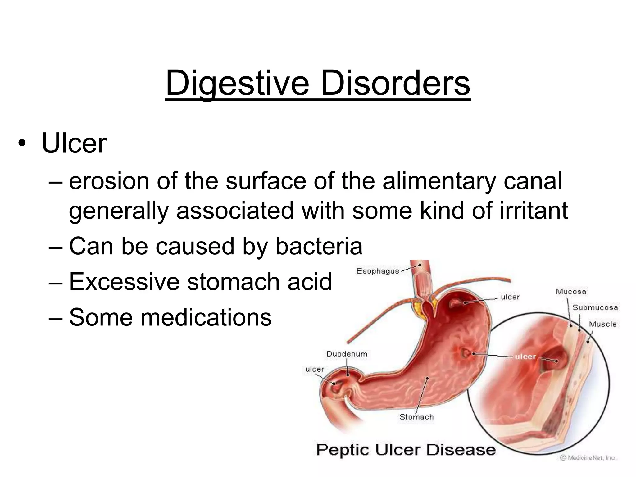 The digestivesystem and disorders | PPTX